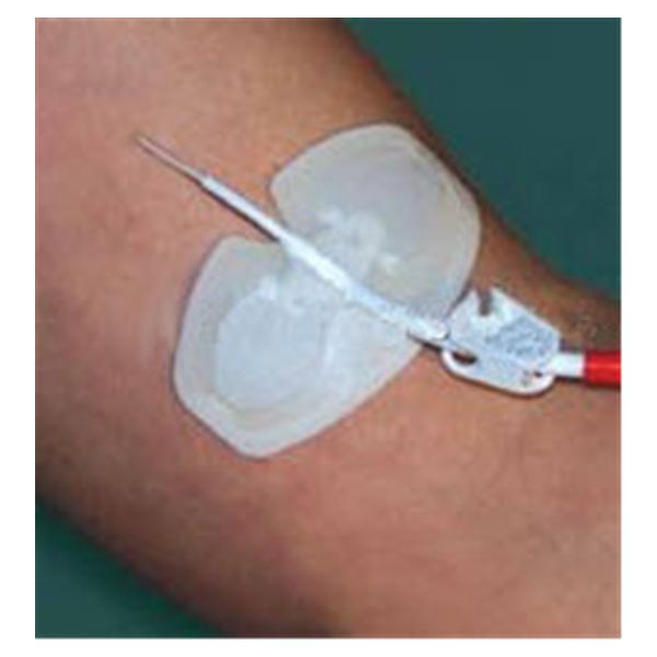 Centurion Medical Products Device Catheter Securement WingGuard PICC S ...