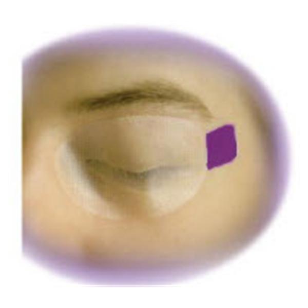 Sharn Eye Protector Sensitive Eyegard Trans Hypoallergenic Disp 50Pr/B ...
