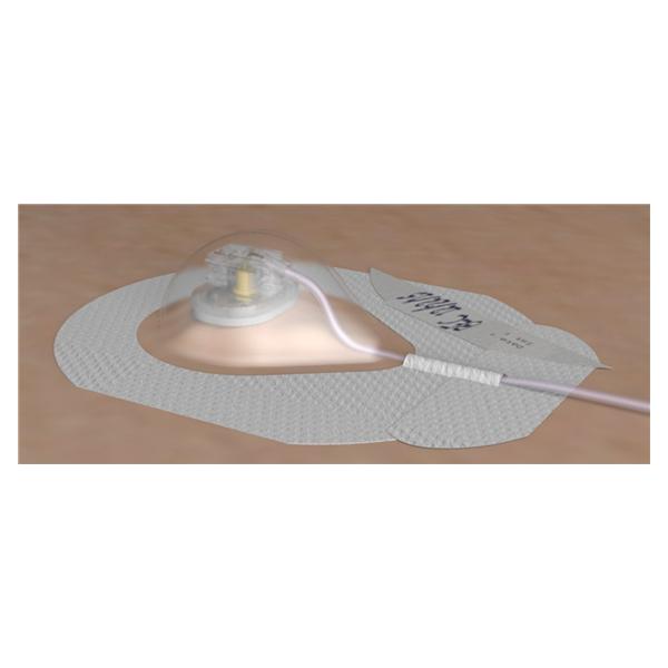 Bard Access Systems Kit Port Access AllPoints 20gx1" With GuardIV Dres ...