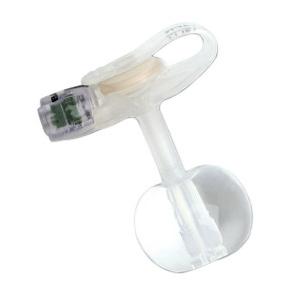 AMT Mini Classic Balloon Button Feeding Device 16Fr, 4-2/5cm Stoma ...