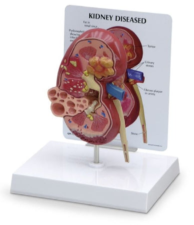 Nasco Kidney Models - MODEL, KIDNEY, W/PATH - SB46337U — Grayline Medical