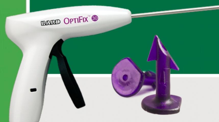 Bard OptiFix Absorbable Fixation Systems - SYSTEM, ABSORB FIXATION, 30 ...