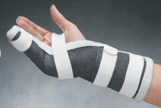 North Coast Medical Delta-Cast Conformable Fiberglass-Free Casting Tape ...