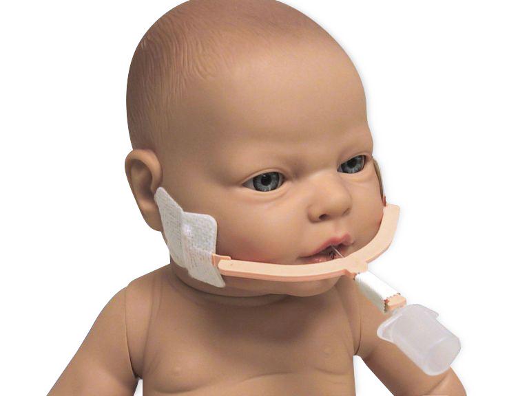 NeoTech Products NeoBar ET Tube Holders - HOLDER, TUBE, ENDOTRACHEAL ...