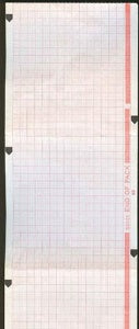 Zoll Medical Fan Fold Recorder Paper - PAPER, RECORDER, FAN FOLD, F ...