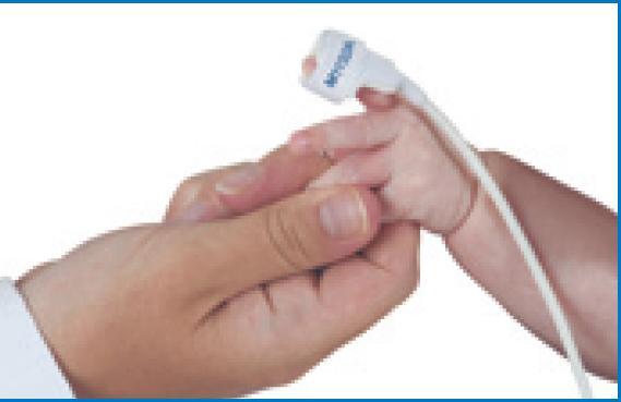 Philips SpO2 Wrap Sensors - SpO2 Sensor, Hand / Foot, Neonatal, 4.9 ...