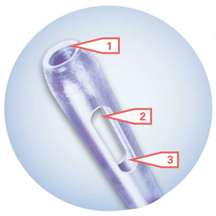 Gynex Suresample Endometrial Sampler - SureSample Endometrial Sampler ...