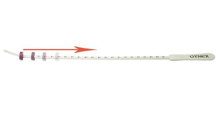 Gynex Single Use Accu-Sound Uterine Sound - Uterine Sound, Plastic, St ...