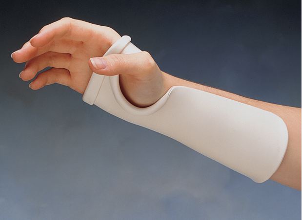 North Coast Medical Radial Bar Wrist Splint | Cock-Up Precut Splint ...