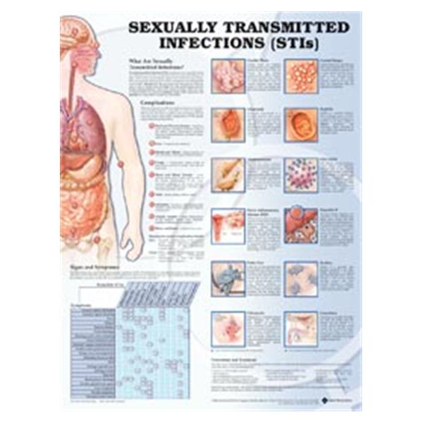 Wolters Kluwer Health Chart Educational Sexually Transmitted Infection ...