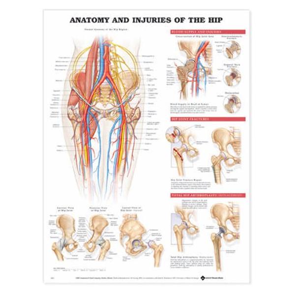 Wolters Kluwer Health Chart Anatomical Anatomy and Injuries of the Hip ...