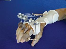 Phoenix Outrigger by AliMed — Grayline Medical