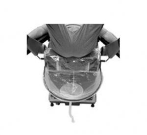 Steris Fluid Collection System - Steris Fluid Collection Bag, Nonsteri ...