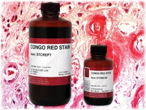 American Mastertech Scientific Congo Red Stain - STAIN CONGO RED PINT ...
