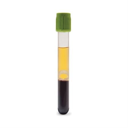 BD Vacutainer Barricor Plasma - Lime - 13 x 100mm 4.5mL — Grayline Medical