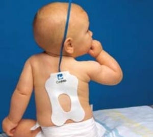 Conmed ECG Back Pads - ECG Back Pad Electrode, Radiopaque, Pediatric ...