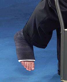 BSN Medical Delta-Cast Conformable Elite Cast Tape - Delta-Cast Elite ...