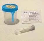 BD Vacutainer Urine Collection Kits - DBD-KIT, COLLECTION, VACUTAINER ...
