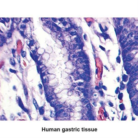 Optimized Giemsa Stain Kit Bone Marrow Control Slides — Grayline Medical
