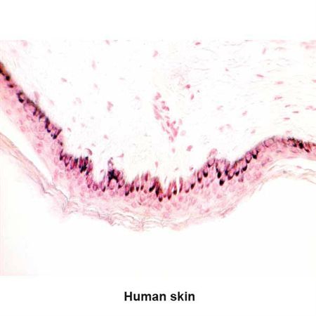 Fontana-Masson Stain Set Melanin Control Slides — Grayline Medical