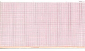 Graphic Controls Medical Chart Recording Papers - Physio Controls ECG ...