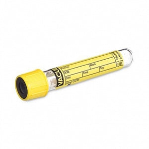 Greiner Bio-One Vacuette Non Additive Urine Tubes - Vacuette Urine CCM ...