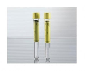 Greiner Bio-One Vacuette Non Additive Urine Tubes - Vacuette Urine CCM ...