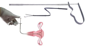 Gynex Serpentine Grasper I. U.D. Remover - Serpentine Grasper IUD Remo ...
