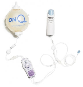 Halyard Health On-Q Pump with Select-A-Flow - On-Q Pump System, 400 mL ...
