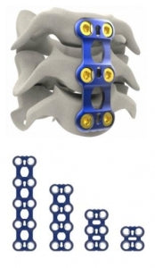 ChoiceSpine Anterior Cervical Plating System - Anterior Cervical Plate ...