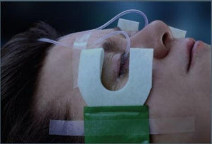 MorTan The Morgan Lens Delivery Sets - Medi-Duct Fluid Management Syst ...