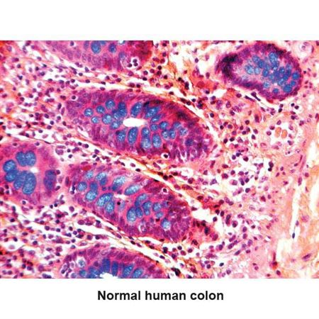 Modified Genta Triple Stain Kit 100mL Kit — Grayline Medical