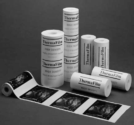 Sony Ultrasound Paper - Ultrasound Paper, 110 mm x 20 m - HPM-1100HD ...