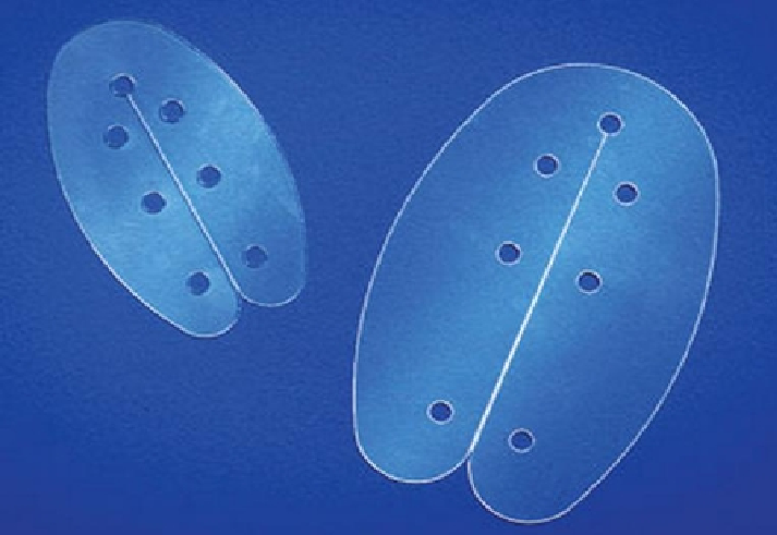 Micromedis Bi-Valve Nasal Splints - Bi-Valve Nasal Splint, Oversize Th ...