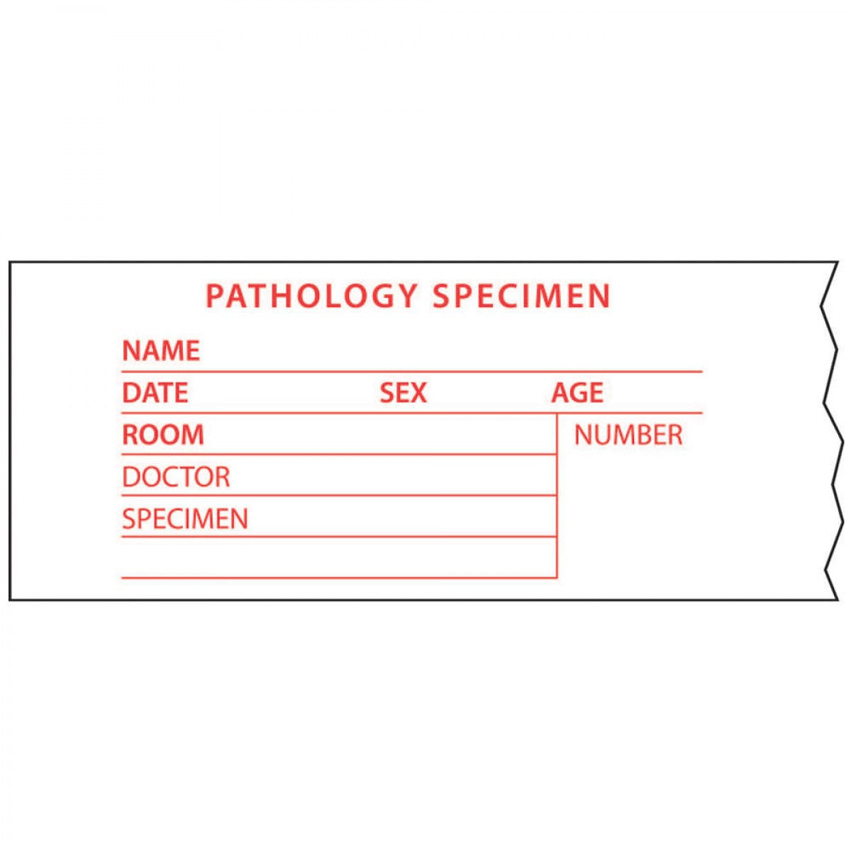 Lab Communication Tape (Removable)Pathology Specimen 2" X 500" White ...