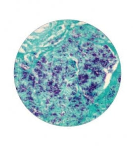 Statlab Medical Products Inc Acid Fast Bacteria Stain Kit - STAIN KIT — Grayline Medical