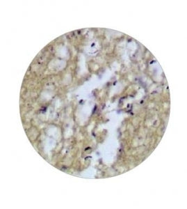 Statlab Medical Products Inc Gram Stain Kit - STAIN KIT GRAM - KTMGS ...