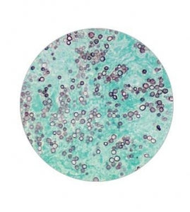 Statlab Medical Products Inc GMS (Mod. Gomori Meth) Stain Kit - STAIN ...