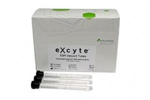 Value Tek Excyte ESR Vacuum and Non-Vacuum Tubes - Excyte ESR Vacuum a ...