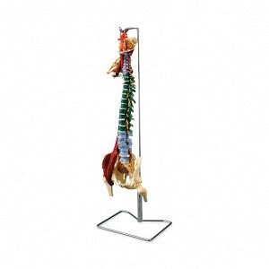 Wolters Kluwer Spine Models - Muscled Spine with Disorders Model - CH5 ...