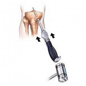 Zimmer Biomet Bone Dowel Harvesting Tube - VA Only Disposable 11 mm Bo ...