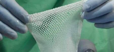 Molnlycke Healthcare US E-Z Derm Porcine Xenograft (Mesh) - EM-106 EZ ...