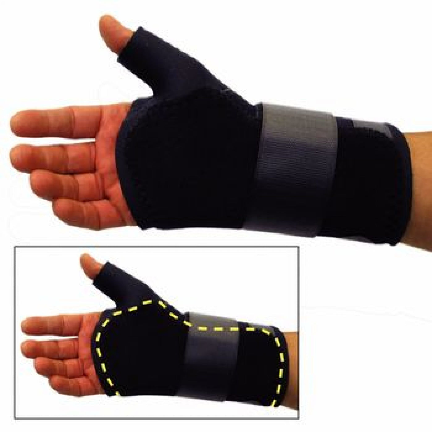 Benik W-313 Wrist/Thumb Splint — Grayline Medical